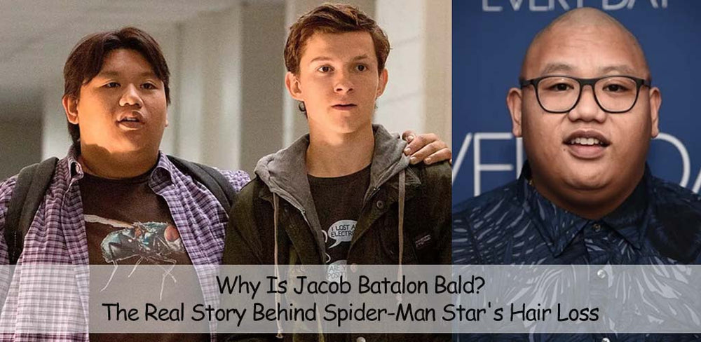 Why Is Jacob Batalon Bald? The Real Story Behind Spider-Man Star's Hai ...