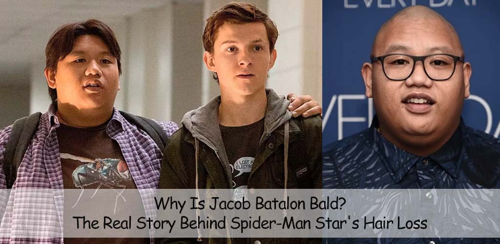 Why Is Jacob Batalon Bald? The Real Story Behind Spider-Man Star's Hai ...